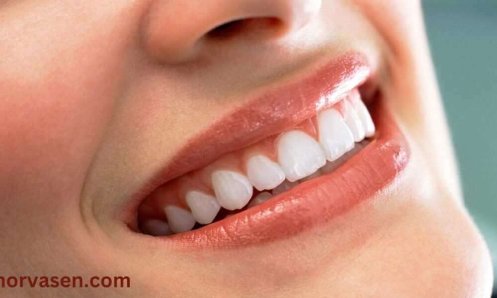 The Ultimate Guide to Gum Recession: Causes, Symptoms, and Treatments ...